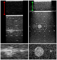 Seismic Imaging Method for Medical Ultrasound Systems | Phys. Rev. Applied