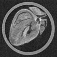 Phys. Rev. Applied 7, 044029 (2017) - Single-Shot X-Ray Phase-Contrast ...