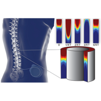 Aris-Taylor dispersion in the subarachnoid space | Phys. Rev. Fluids