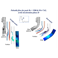 Pulsatile flow hemodynamics in stenosed arterial curvatures | Phys. Rev ...