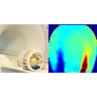 Kerker Effect in Ultrahigh-Field Magnetic Resonance Imaging | Phys. Rev. X