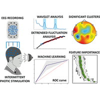 Harnessing Long-Range Temporal Correlations for Advanced Epilepsy ...